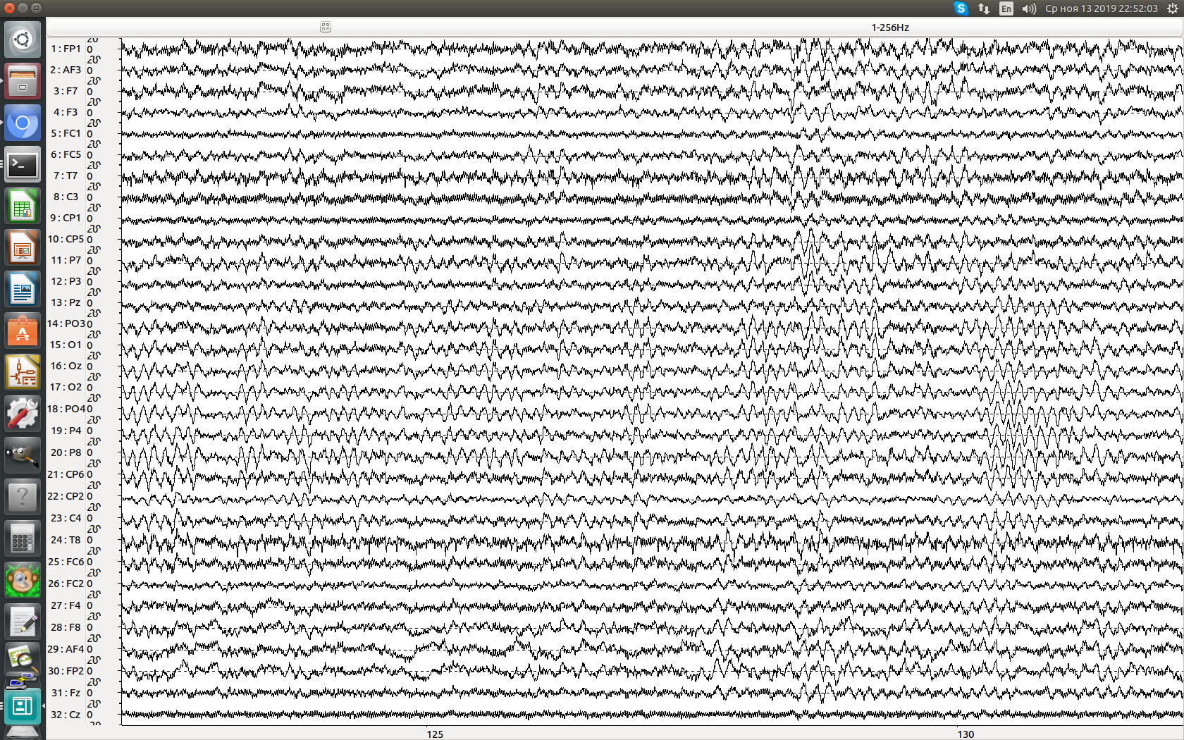 FreeEEG32 | Нейроэкономическая Интеллектуальная Система Поддержки Принятия Решений - NeuroIDSS